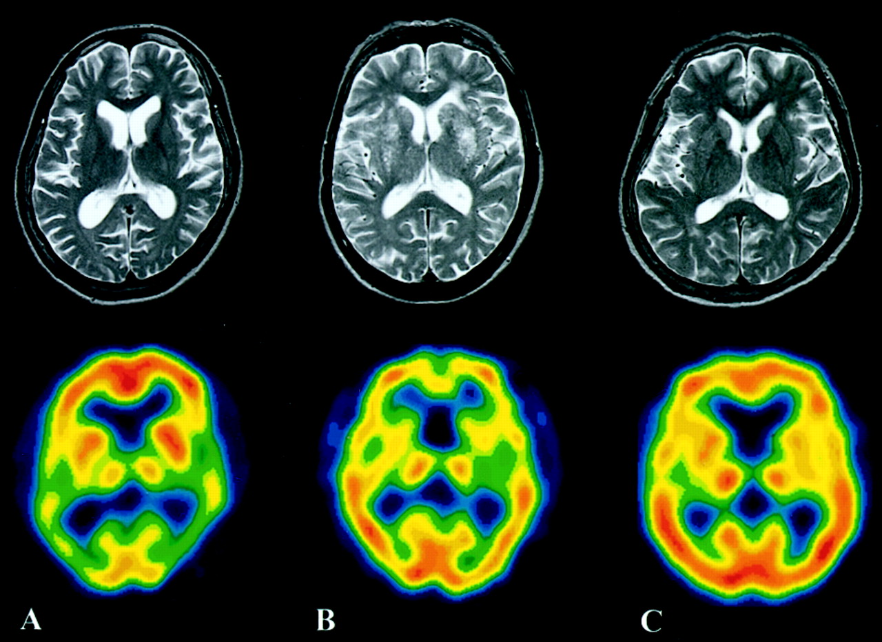 INSTRUMENTACIÓN Y EQUIPOS EN IMÁGENES DIAGNOSTICAS: SEMANA 6