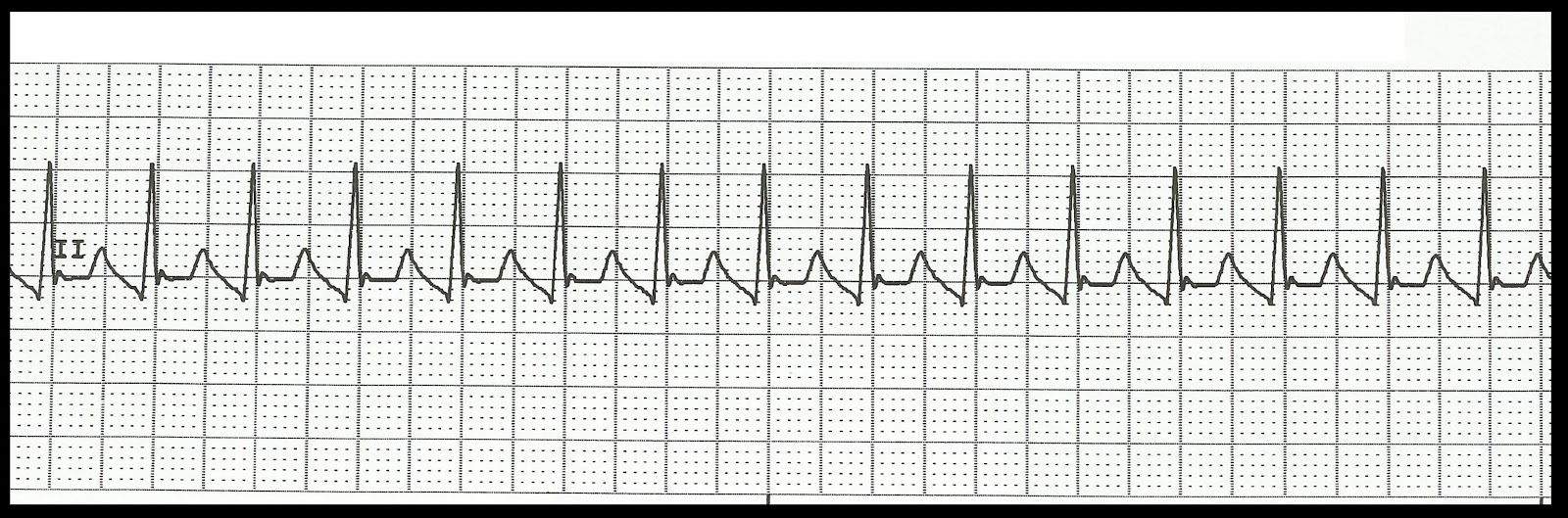 Basic EKG Rhythm Test 07
