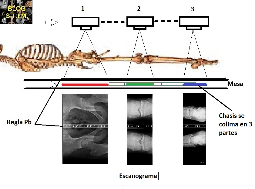 Sobre técnicas de imágenes médicas (Blog STIM): Escanograma y ...