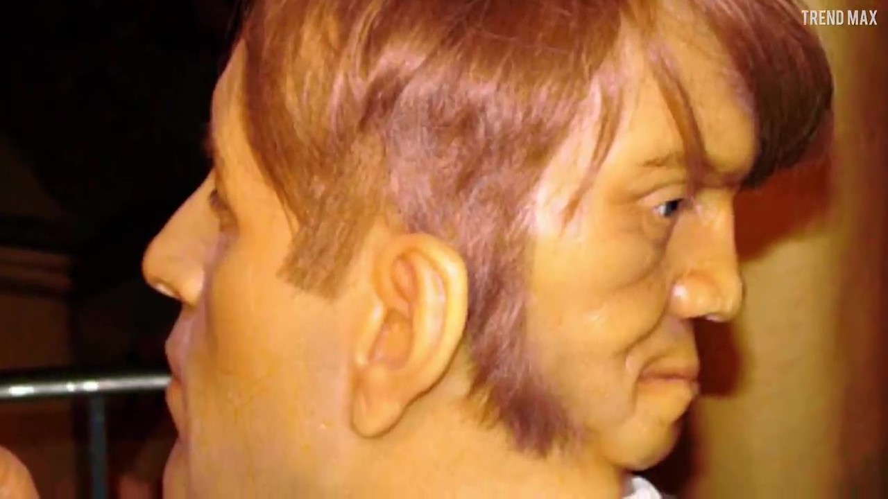 10 people with extra body parts.