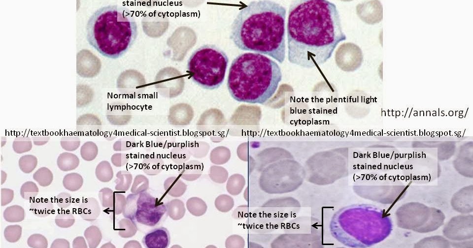 Haematology in a NutShell: Large Lymphocytes
