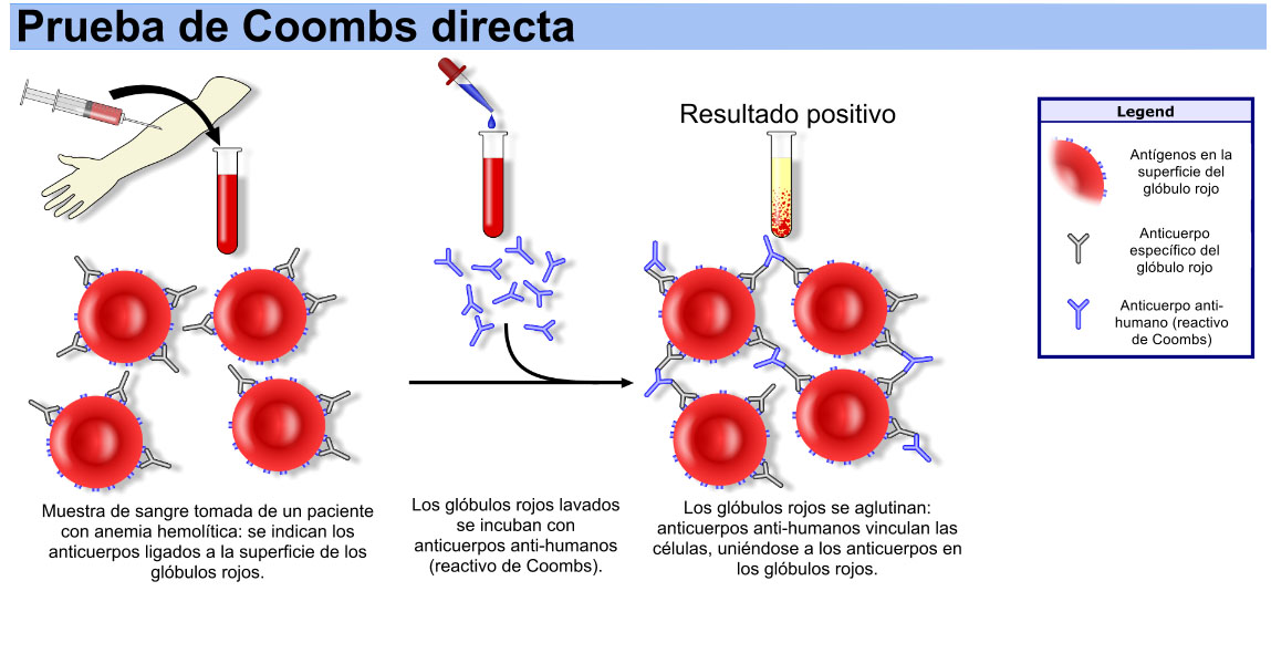 Prueba de coombs; Test de Consumo de Globulina Antihumana; Test de ...