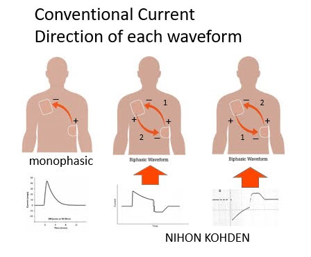 Capnography Buyers City: Weak points of CardioLife TEC-5600 series ...