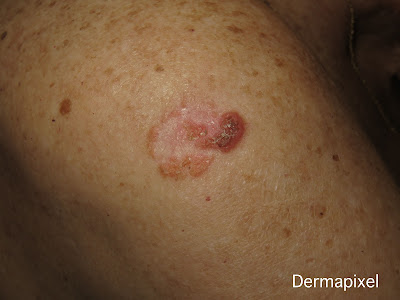 Dermapixel: abril 2020