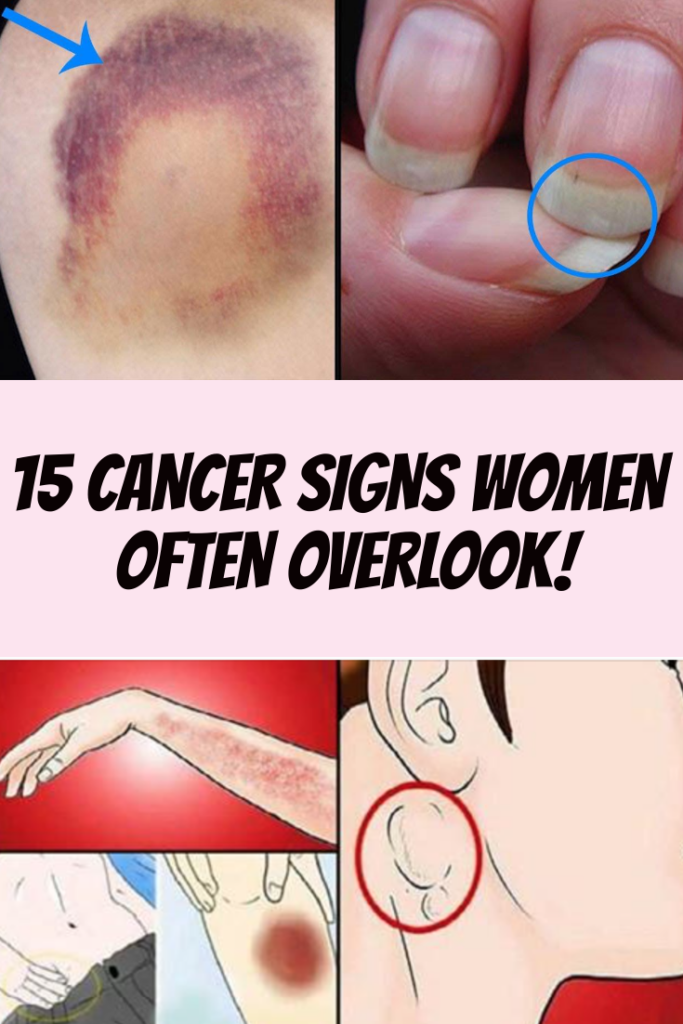 15 Cancer Signs Women Often Overlook!