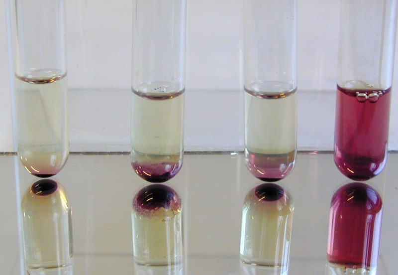 Hémolyse et son exploration - BIOLOGIE MEDICALE