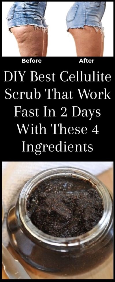 DIY Best Cellulite Scrub That Work Fast In 2 Days! With most Powerful ...