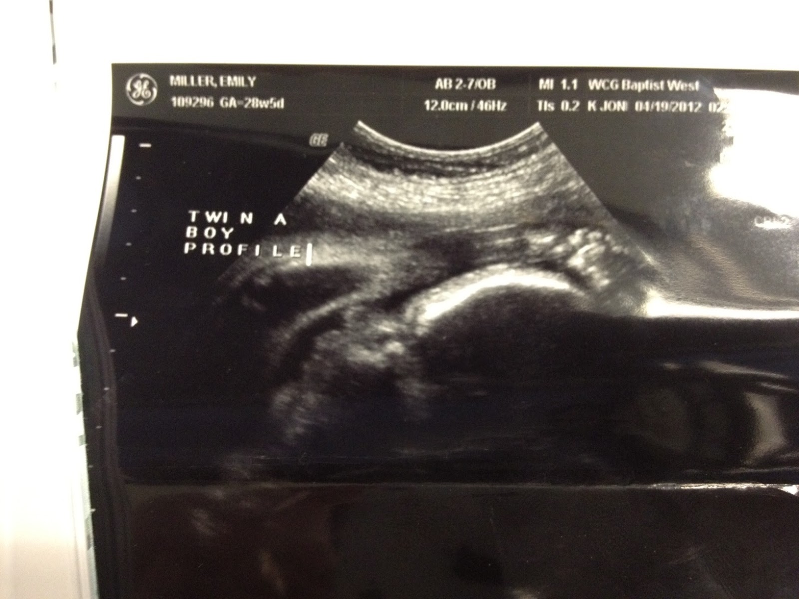 AlwaysanEm: Ultrasound! 28 Weeks and 5 days