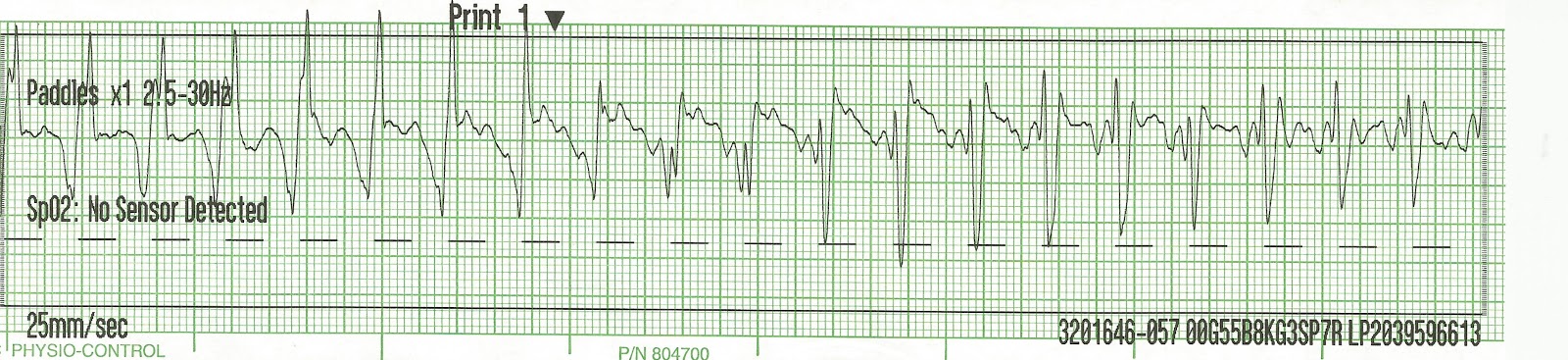 Float Nurse: Code Blue: Respiratory arrest