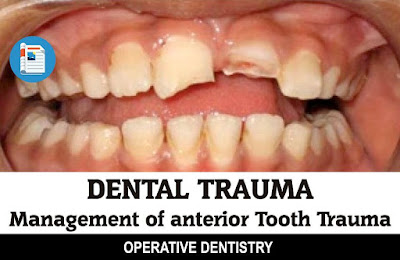 DENTAL TRAUMA: Biological approach for management of anterior Tooth ...