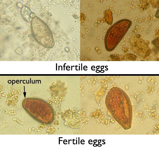 Creepy Dreadful Wonderful Parasites: Answer to Case 610