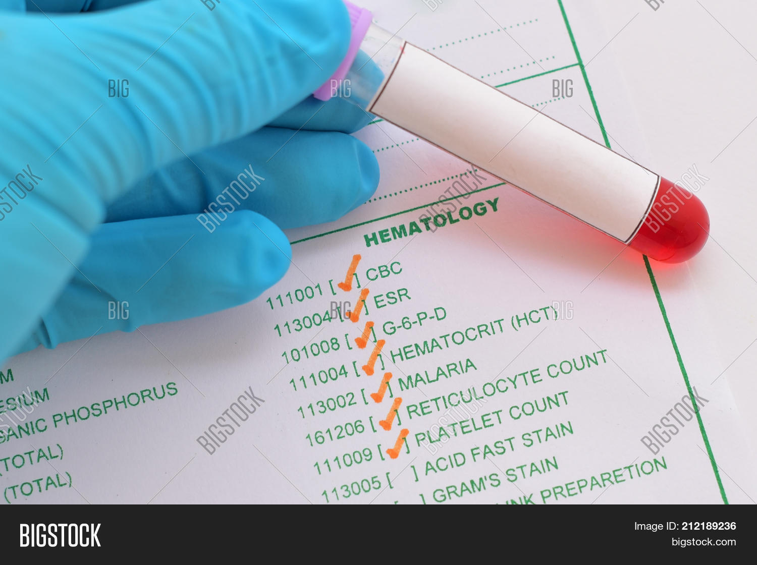 Hematology Tests and Procedure - Imad Analis Blog
