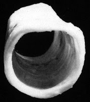 Candy Pets: Santé: Le collapsus trachéal chez le chien