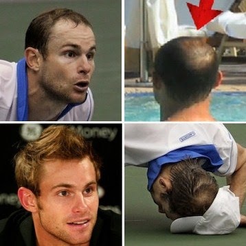 kenneth in the (212): The All-England Hair Club for Men