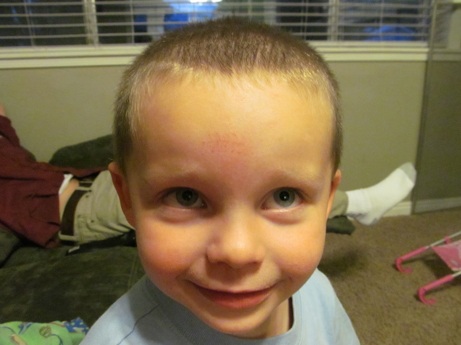 The Miller Family: Chase's "stitched" forehead