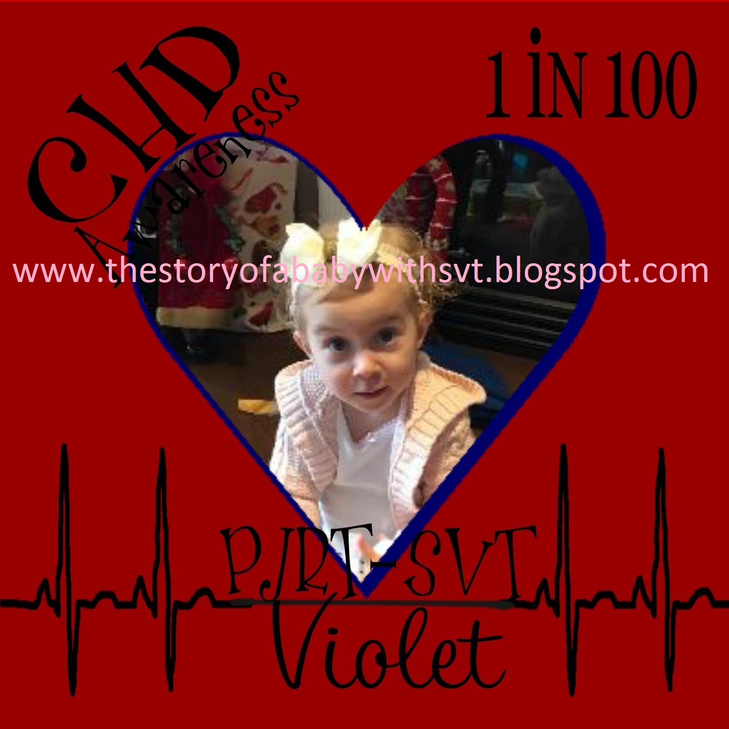 The Story of a Baby with SVT(PJRT): My PJRT Sisters and Brothers