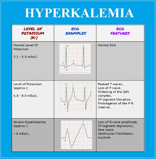 Guidelines for Treatment of Adult Patients With Hyperkalemia