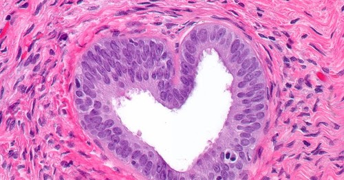 Pathology Lecture Notes - set 2