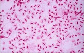 Microbiologia : Haemophilus influenzae