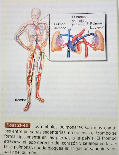 Aeromedicina y cuidados criticos