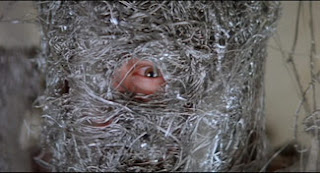 Braces Memories: Braces In The '80s