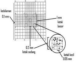 Pemeriksaan Hitung Jumlah Trombosit Manual