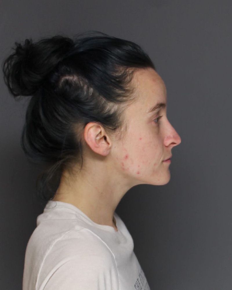 Lion News: Incompetent Bungler Michael "The Hack" Volpe's Latest Victim ...