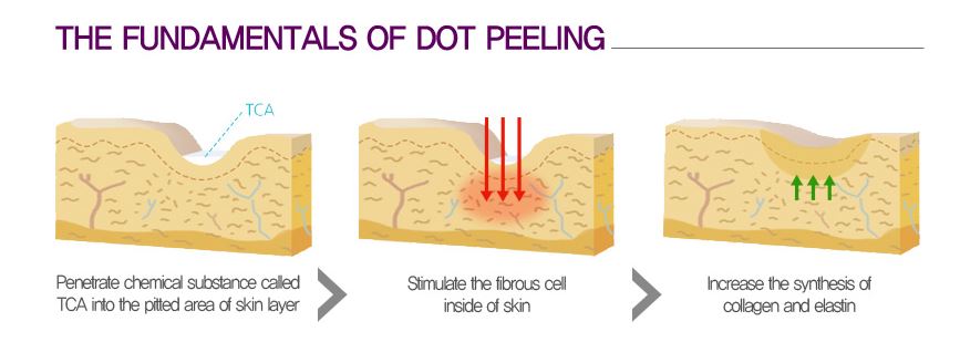 DA Pores & Acne Scar Program