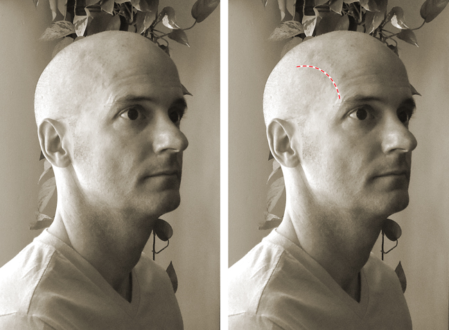 Human Anatomy for the Artist: The Temporal Line: There's a Kansas City ...