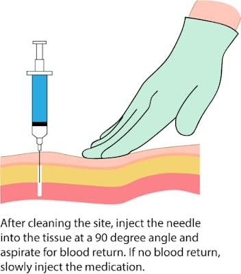 İNTRAMÜSKÜLER ENJEKSİYON