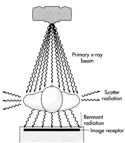 Types Of X Ray Radiation