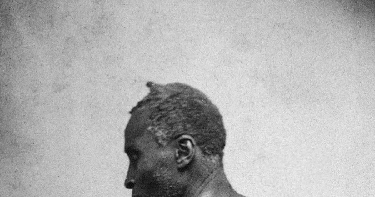 HISTÓRIA LICENCIATURA: Cicatrizes de Gordon, um escravo chicoteado da ...