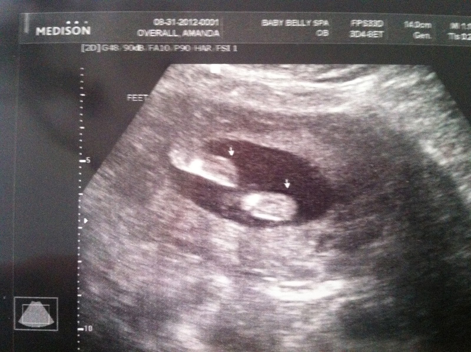 Triple Braided Cord: Gender Reveal