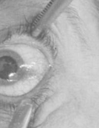 Forensic Thenatology-Signs of Death-Changes in Dead Body With Time ...