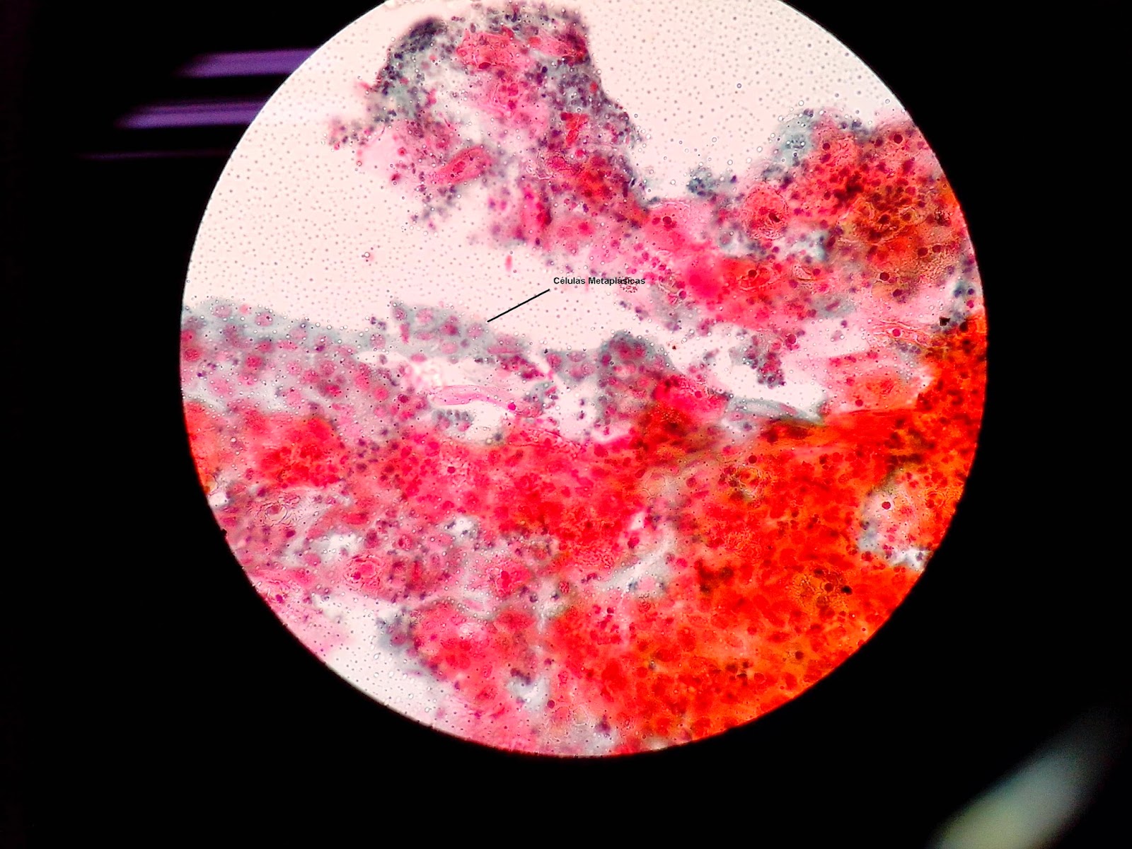 Atlas de Citologia Clínica - Profa Dra Lucila Ludmila Paula Gutierrez ...