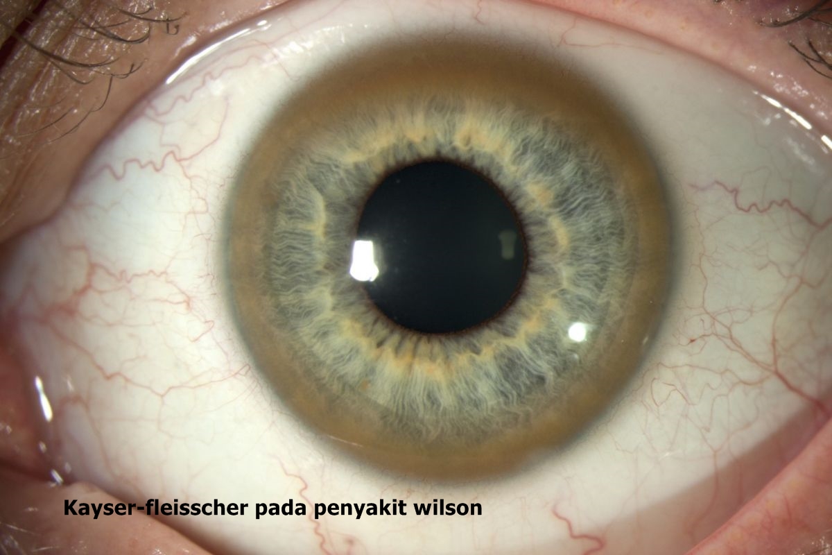 MASOHIPUNK: Pemeriksaan Kelenjar Getah Bening dan Kepala