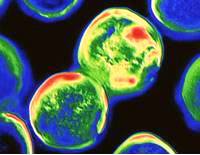 madressilva: Euriarqueotas