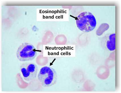 VETERINARY HEMATOLOGY DEXTERVET: band cells