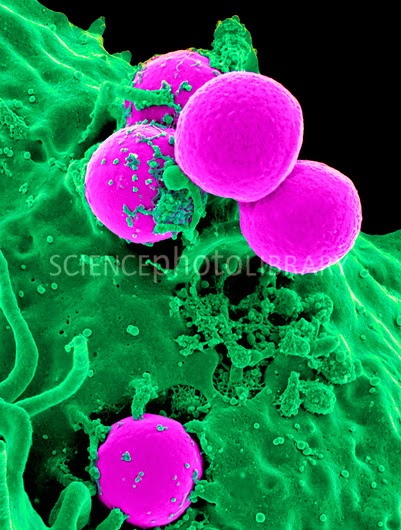 # 58 The immune system - Phagocytes | Biology Notes for A level