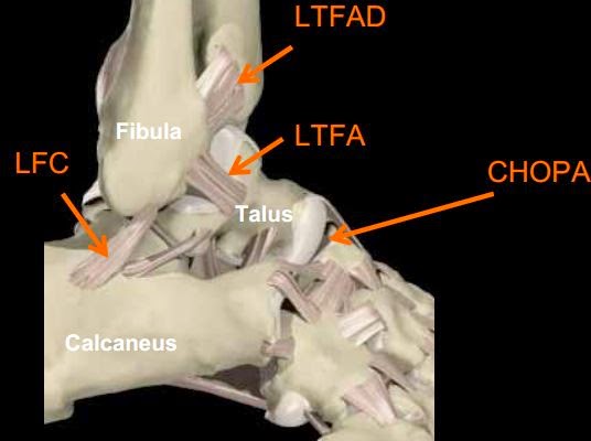 Un médecin du sport vous informe: Entorses et autres traumatismes ...
