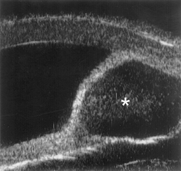 GLAUCOMA SPECIALIST BLOG: "THE GLOG"