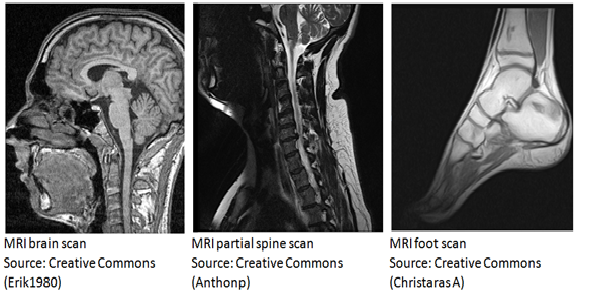 Write: Magnetic Resonance Imaging (MRI)