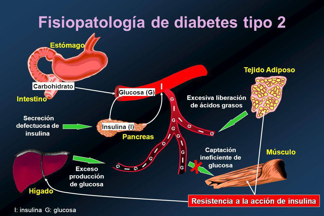 Consejos y Prevencion de Enfermedades : Diabetes, tipos, síntomas y ...