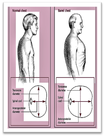 PHYSICAL ASSESSMENT- RESPIRATORY & LYMPHETIC