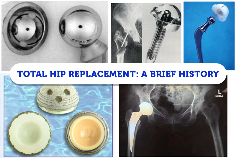 Dr Simon Coffey - An Orthopaedic Surgeon in Sydney,Australia: TOTAL HIP ...