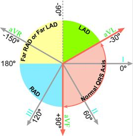 Cardiac Axis