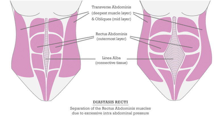 Natural Mama NZ: Physical Preparation for Childbirth