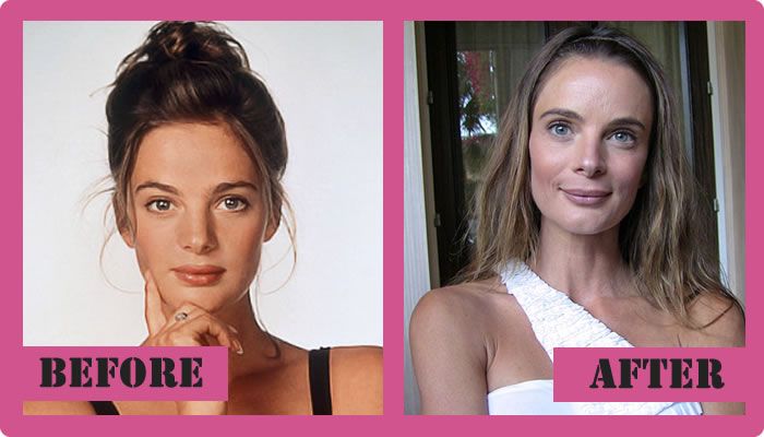 Celebplasticsurgerygossip Gabrielle Anwar Plastic Surgery She Still Looks Natural