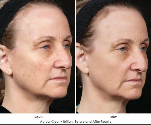 Perfect Body Laser and Aesthetics: Clear & Brilliant