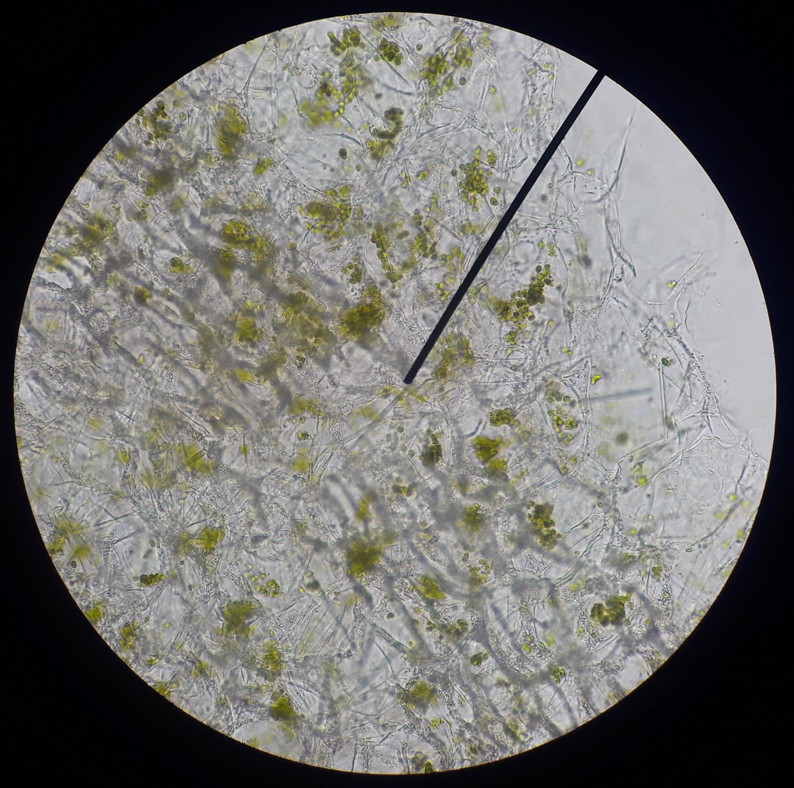 Fialoconidios Resumenes Cuestionarios | Esquemas Y Mapas Conceptuales